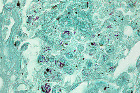 Cold Kinyoun Stain Kit (Malachite Green Counterstain) 100 tests